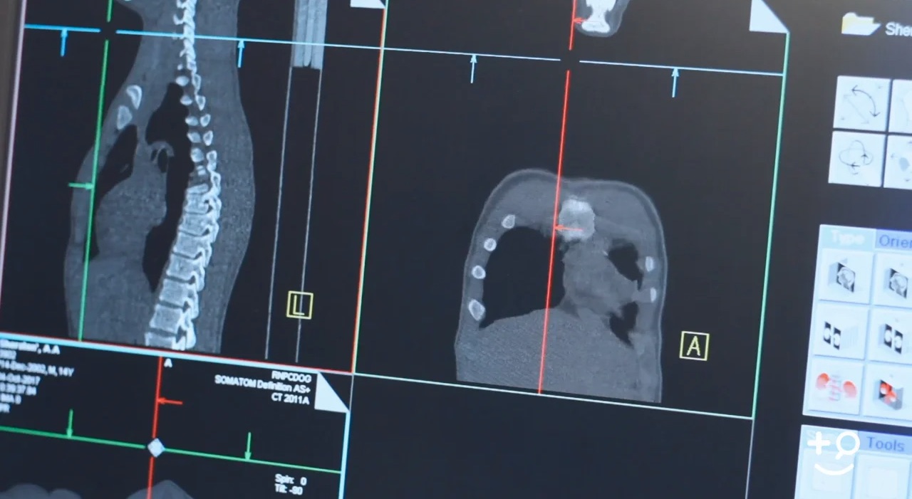 What is an Orthopaedic MRI? - Doctorpedia Article